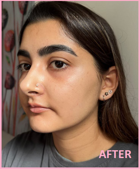 Complete Dr. V TRIO Blemish Range | Oily Skin & Acne Prone Skin ...