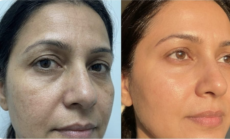 Dr V's Complete Daily Range - Made For Skin Of Colour – Skincare by Dr V